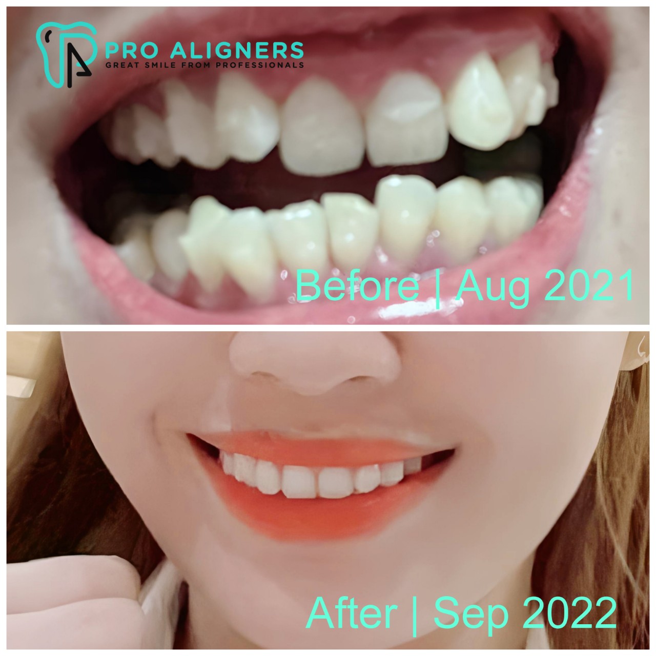 Care Dental – Just another Elementor hosted website ;)